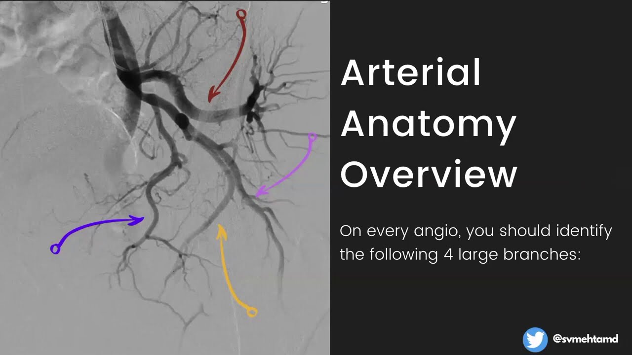 Prostate Artery Embolization: From Basics to Advanced - YouTube