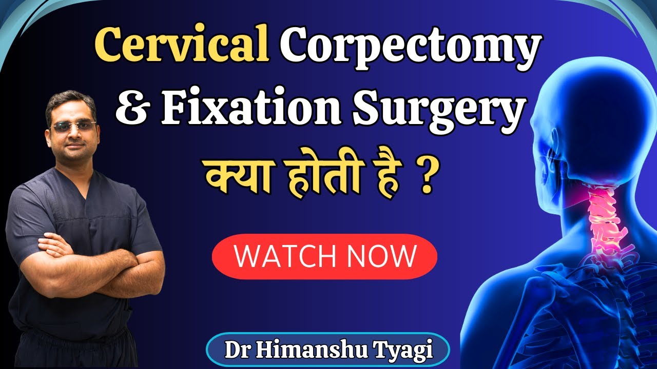 Cervical Corpectomy & Fixation Surgery क्या होती है ? | Dr Himanshu ...