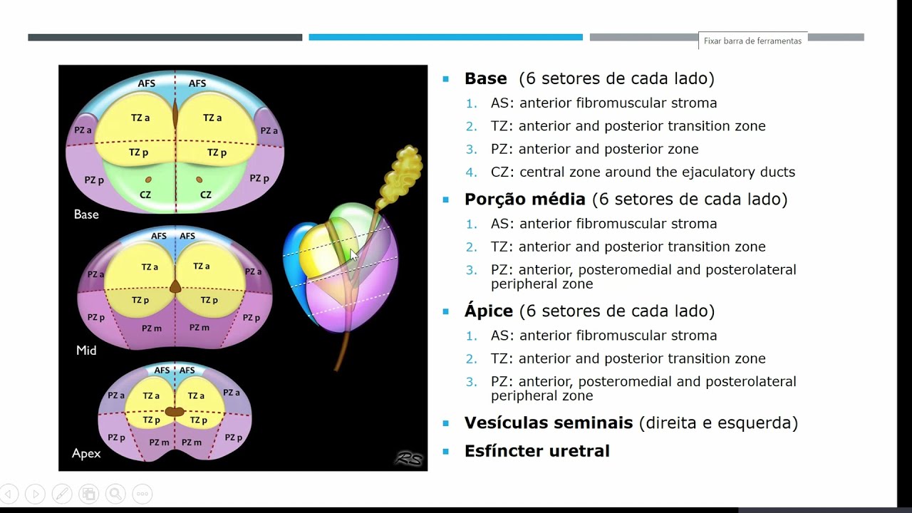 O que é o PIRADS - YouTube