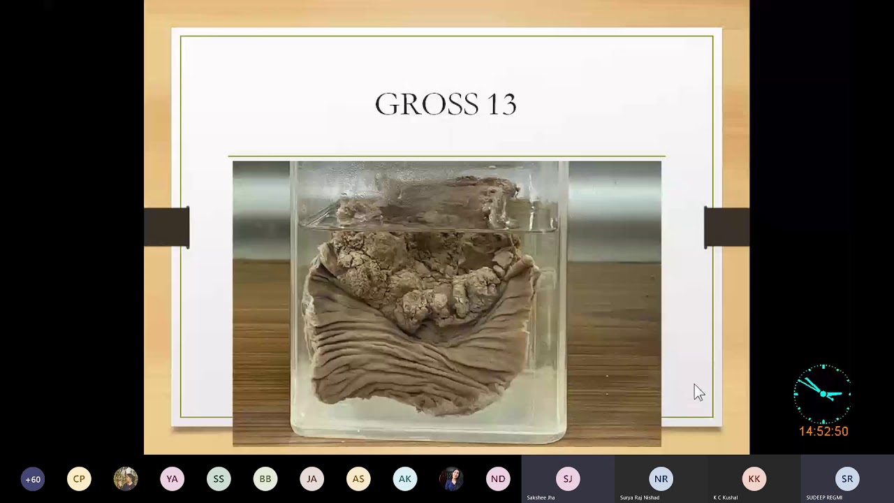 Pathology Gross Specimen 2 - YouTube