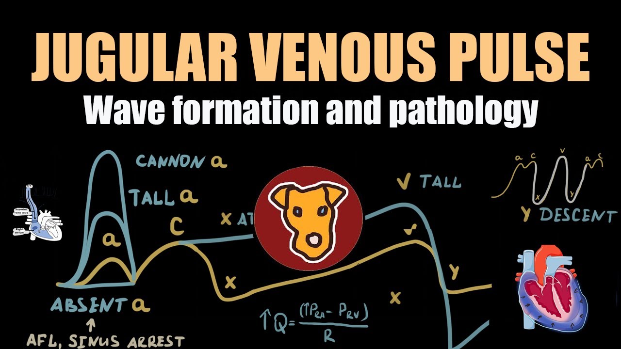JUGULAR VENOUS PULSE, wave formation and pathology - YouTube