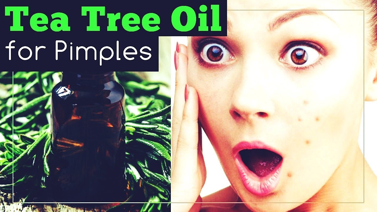 Tea Tree Oil for Pimples: It Works! This Is How To Use It. - YouTube