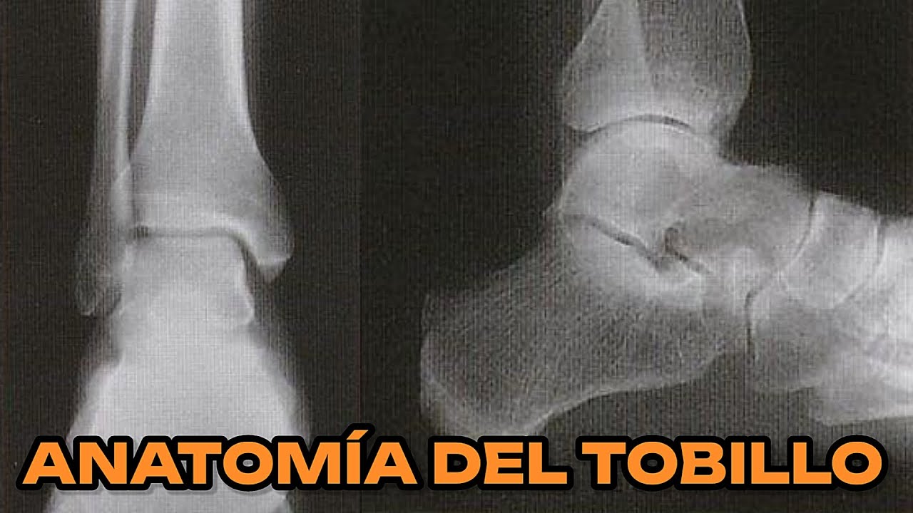 Anatomía Y Radiología Del Tobillo Síndrome De Impacto Posterior Del