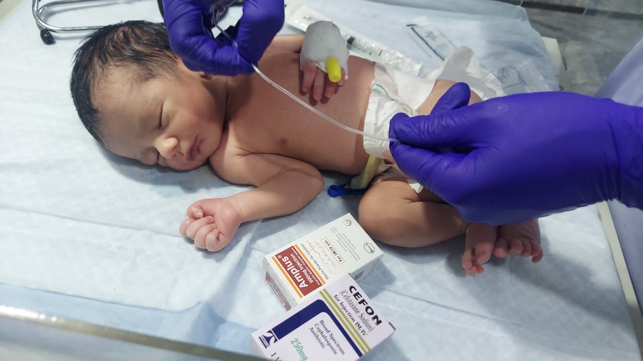 MSL Grade 2: Newborn Baby NG Tube Placement Technique | - YouTube