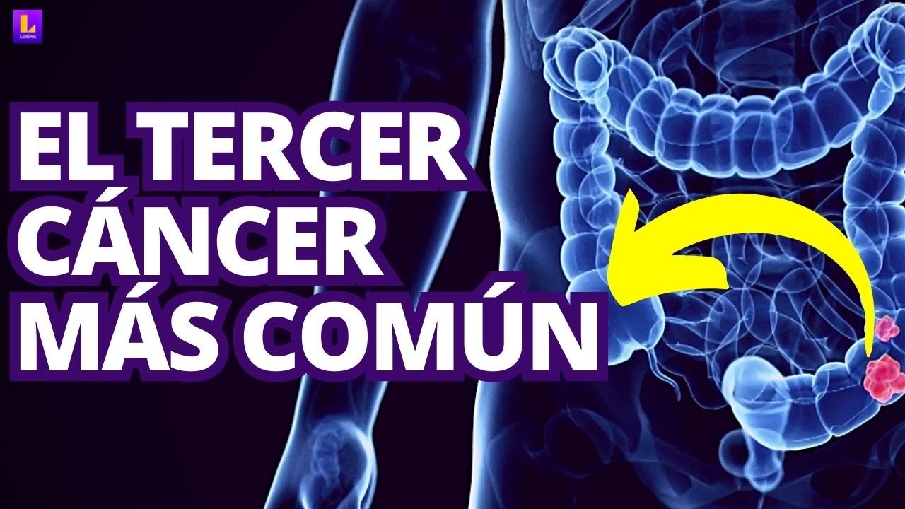 Todo sobre el cáncer de colon: causas, síntomas y tratamiento - YouTube