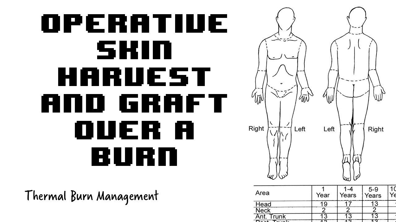 Thermal Burn Management - YouTube