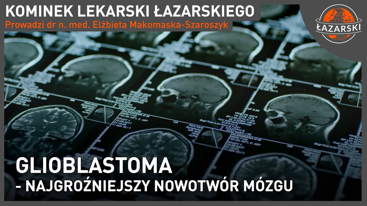 Glejak wielopostaciowy - przypadek kliniczny | Kominek Lekarski UŁa ...