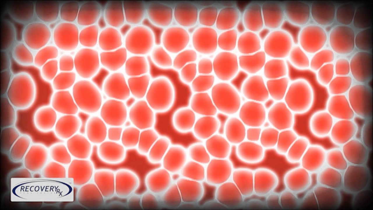 Recovery Rx Pain Therapy from Henleys Medical Supplies - YouTube