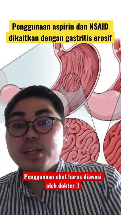 Waspada penggunaan aspirin dan NSAID JANGKA PANJANG!! Dikatikan dengan gastritis erosive - YouTube