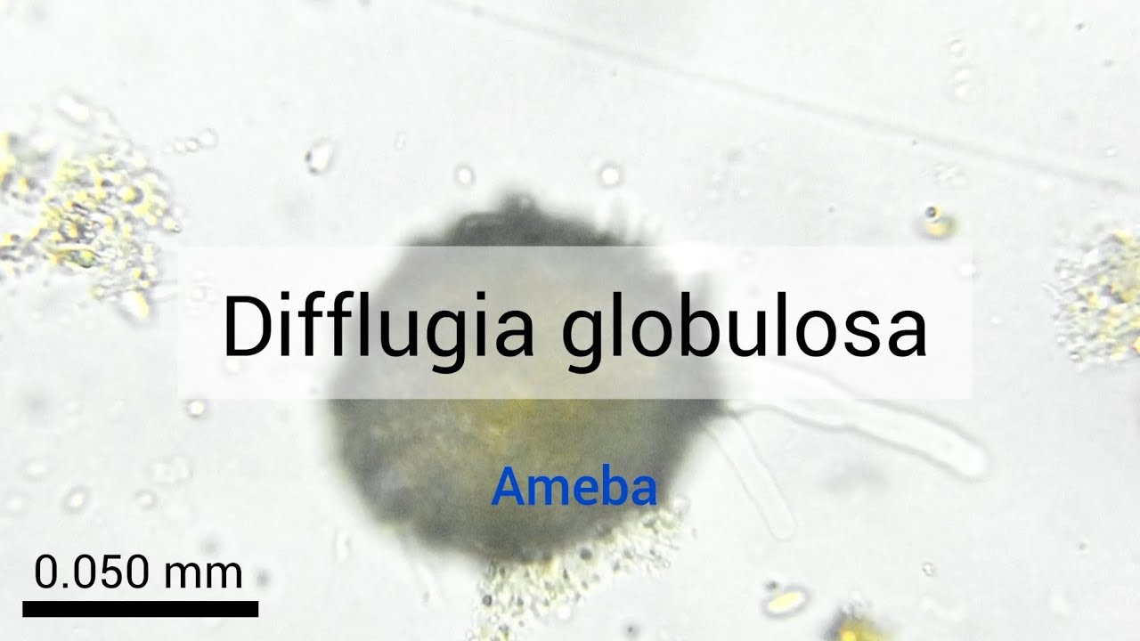 Difflugia globulosa (Ameba) - YouTube