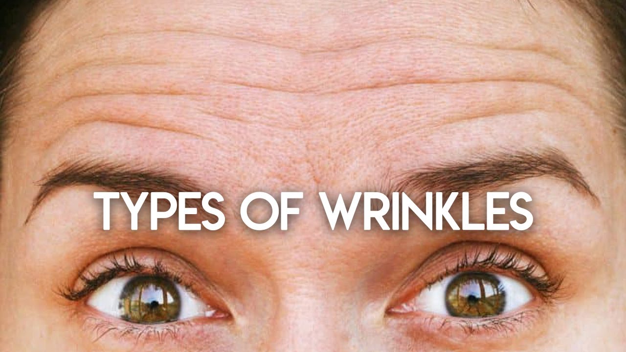 Types of Wrinkles - YouTube