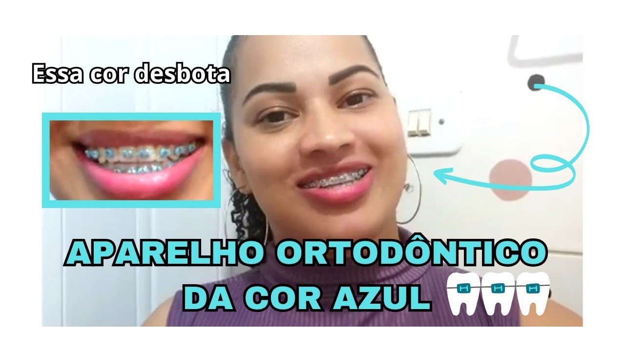 MANUTENÇÃO DO APARELHO ORTODÔNTICO COLOQUEI A COR AZUL - YouTube