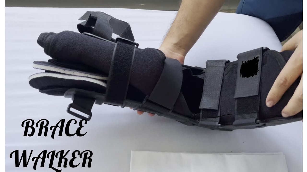 BRACE TIPO WALKER - ¿SABES CÓMO SE PONE? - APRENDE SOBRE EL BRACE NO ...