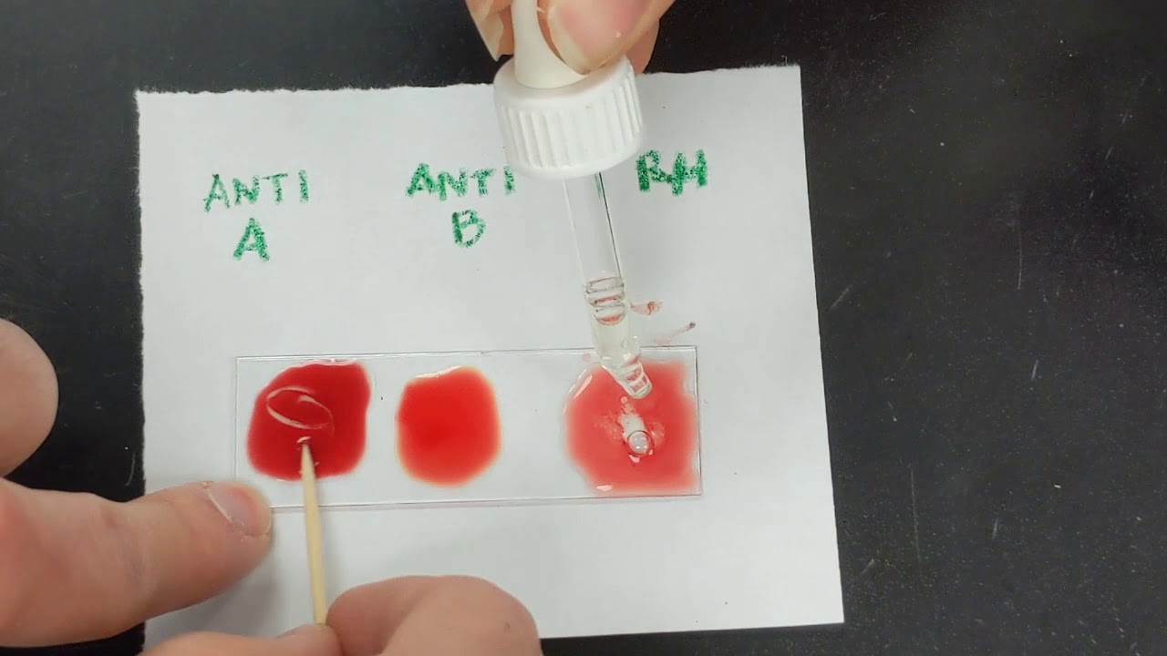 Blood Types Lab - YouTube