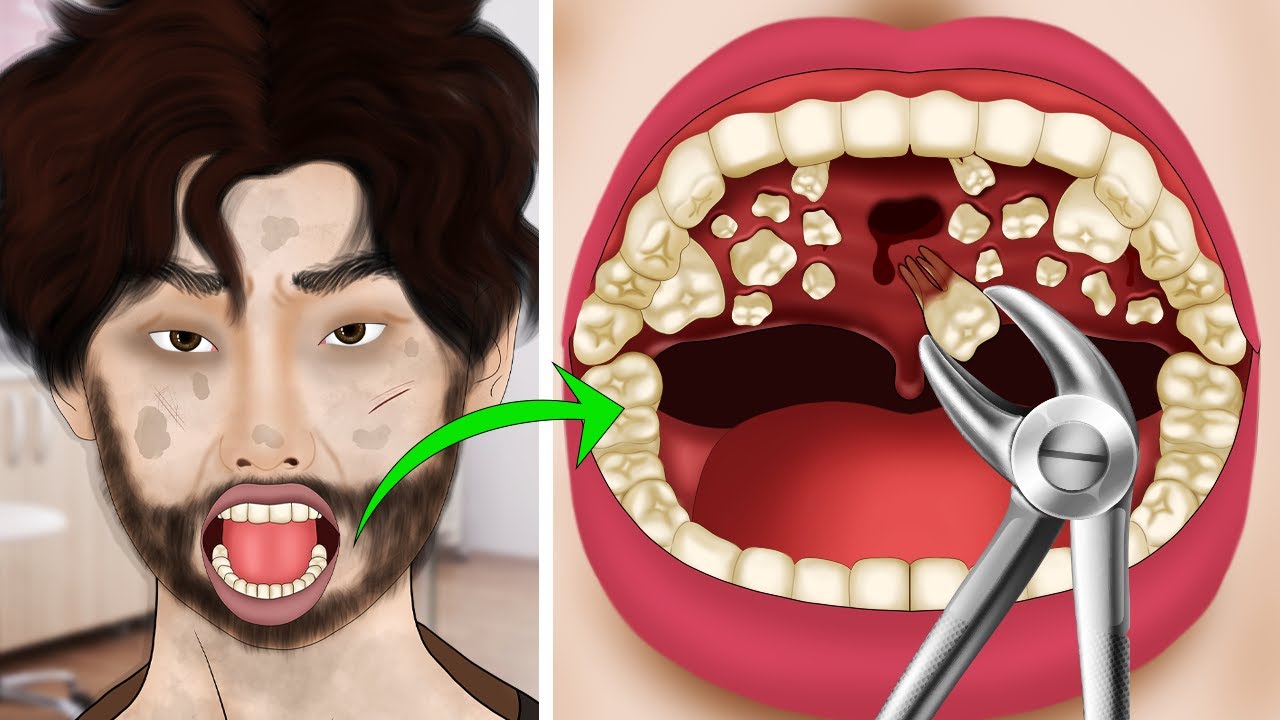 ASMR Removed a lot of misplaced teeth inside the jaw | Oddly Satisfying ...