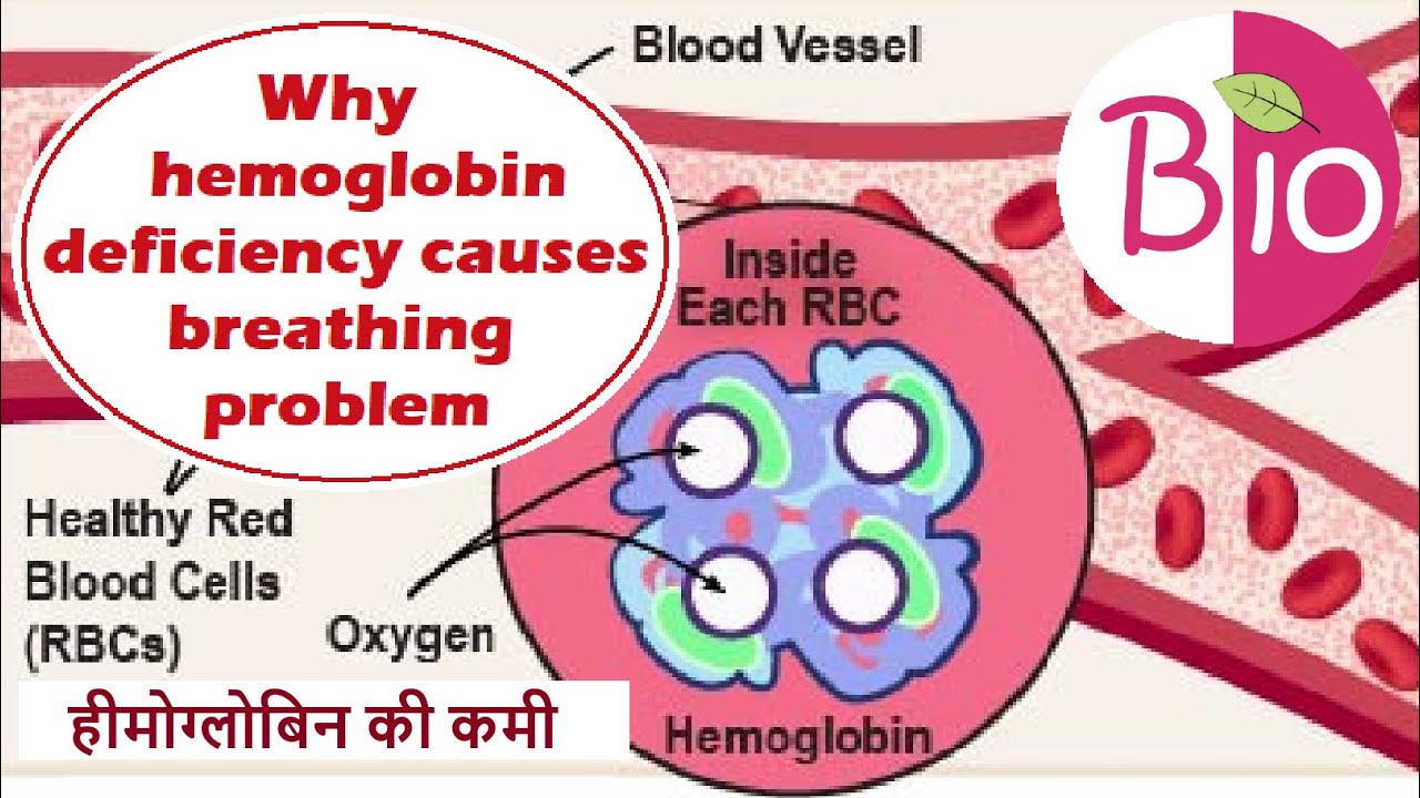 Why hemoglobin deficiency causes trouble breathing? हीमोग्लोबिन की कमी ...