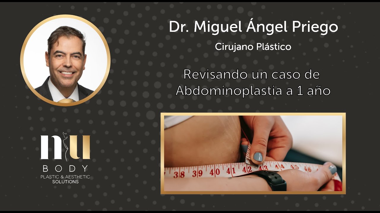 Revisando un caso de #Abdominoplastia a 1 año | Dr. Priego | Nubody | # ...