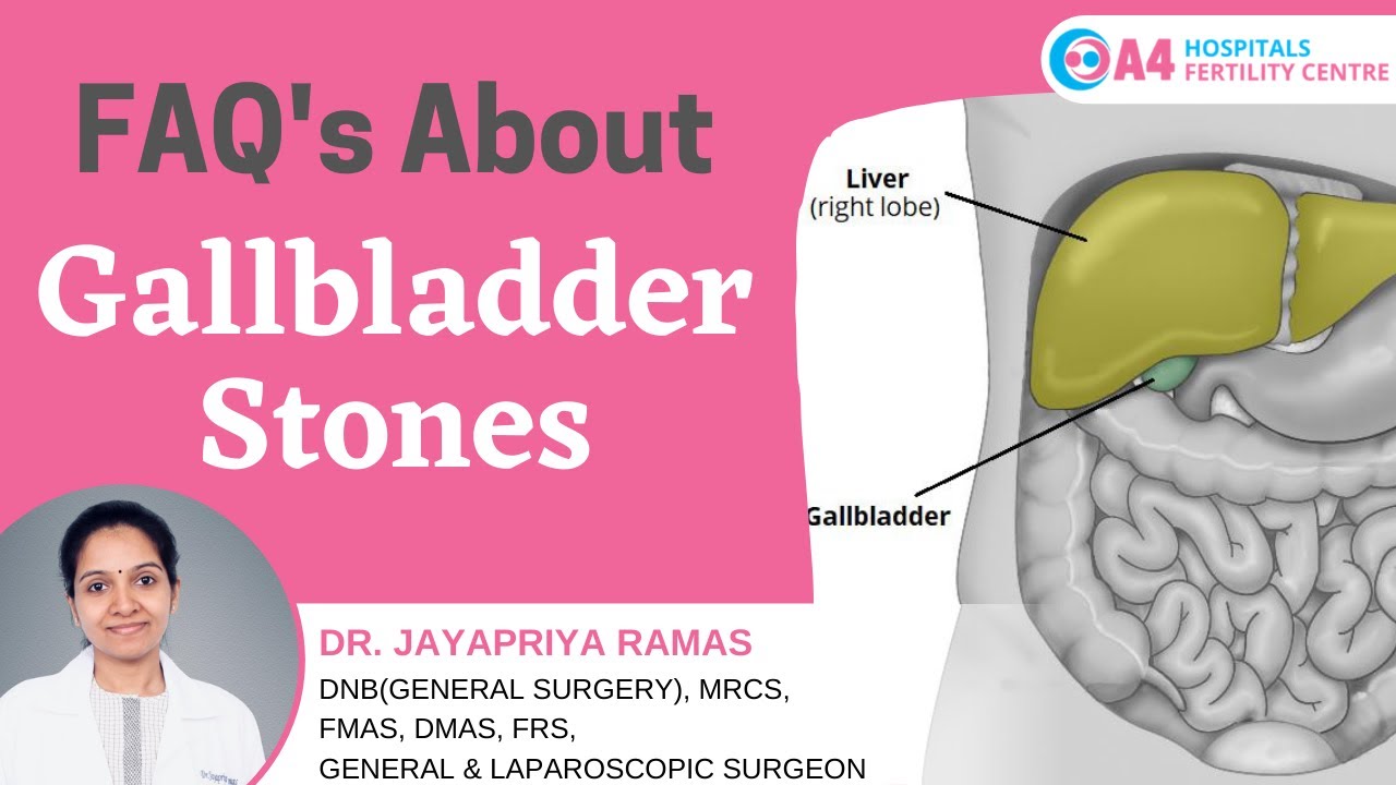 FAQs about Gallbladder stones in tamil by Dr Jayapriya | A4 Hospital ...