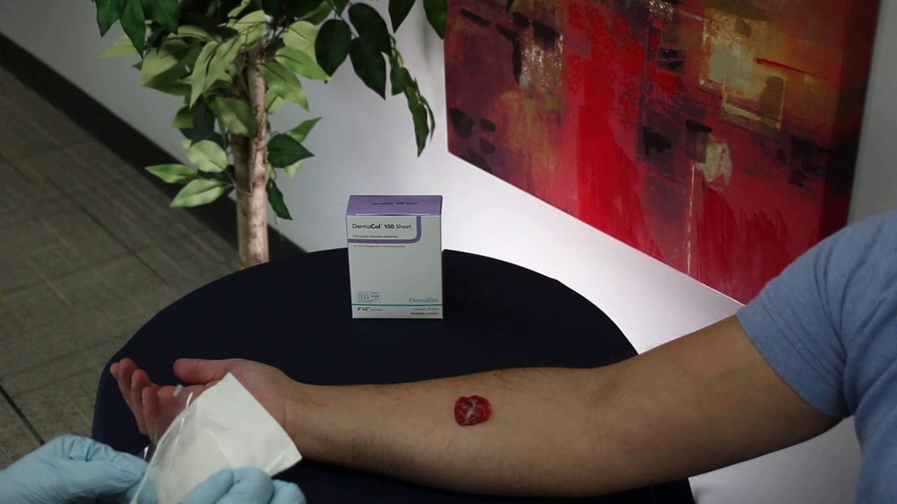 How to Apply DermaRite's DermaCol 100 Sheet Wound Dressing - YouTube