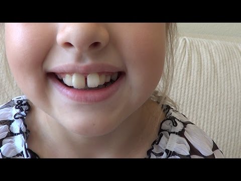 GABRIELLE GETS BRACES | EPISODE 3