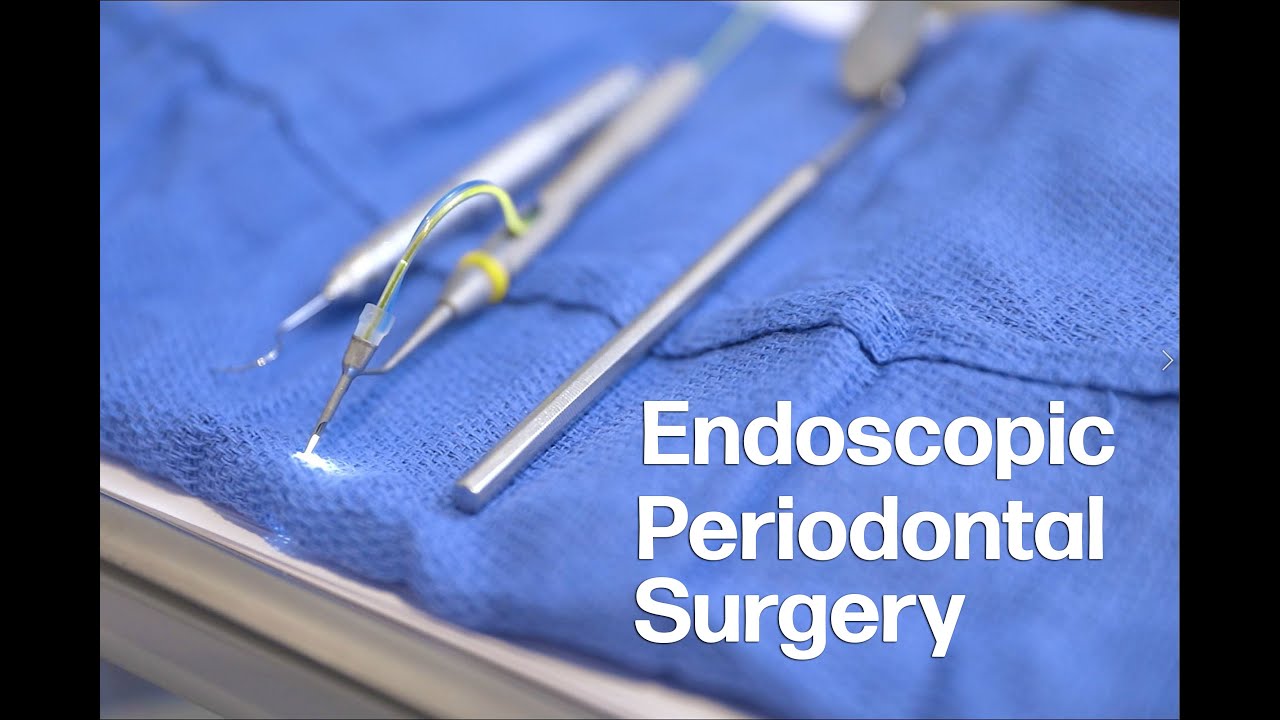 The Benefits Of The Perioscope In Gum Disease Treatment - YouTube