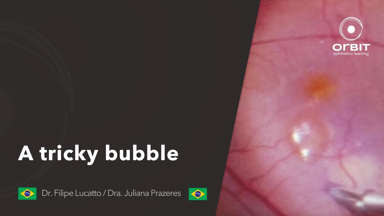 A tricky bubble (Sub ILM Perfluor) - YouTube