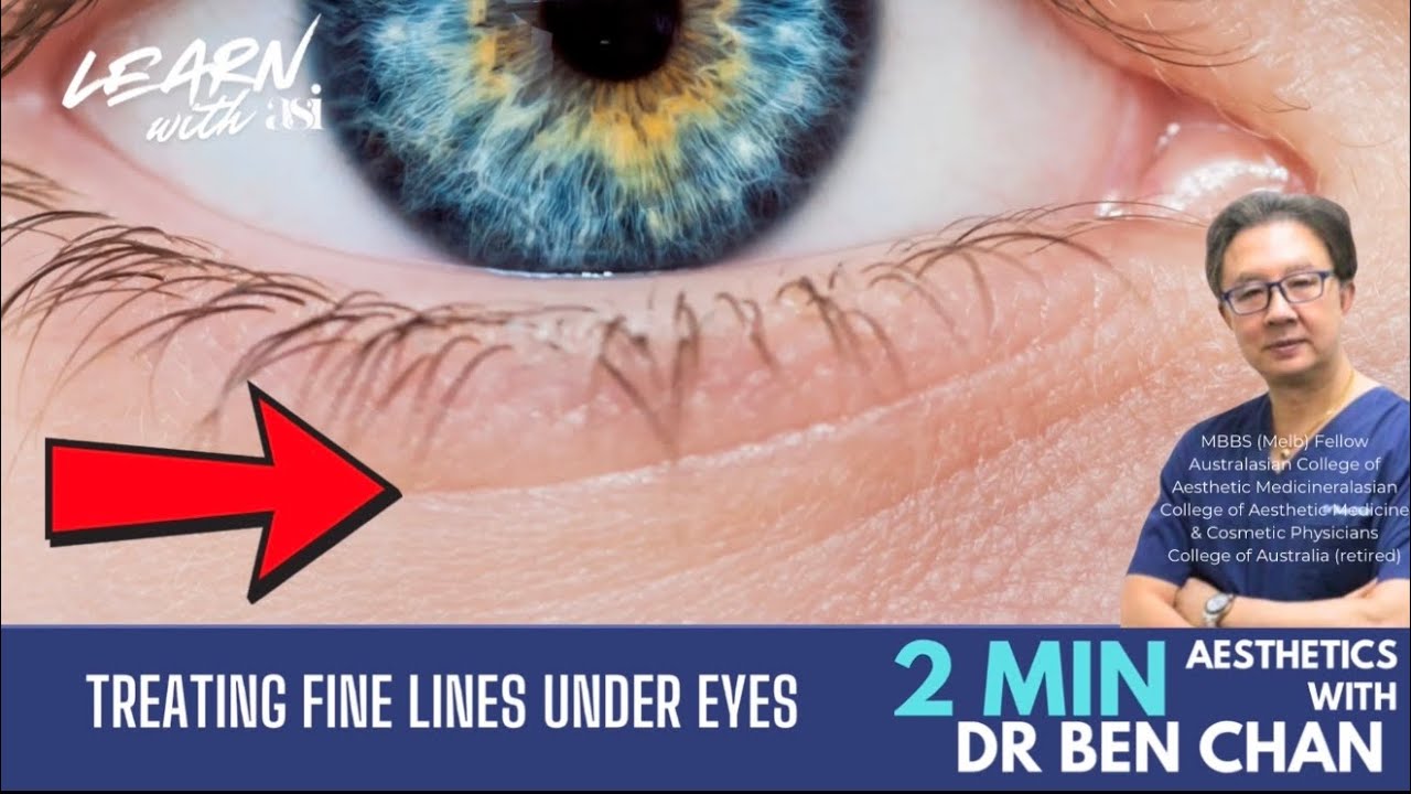 Fine lines on the lower eyelids - YouTube