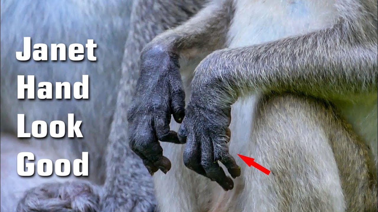 Wow! So Great So See Janet Using Her Hand More Like This - Janet Hand ...