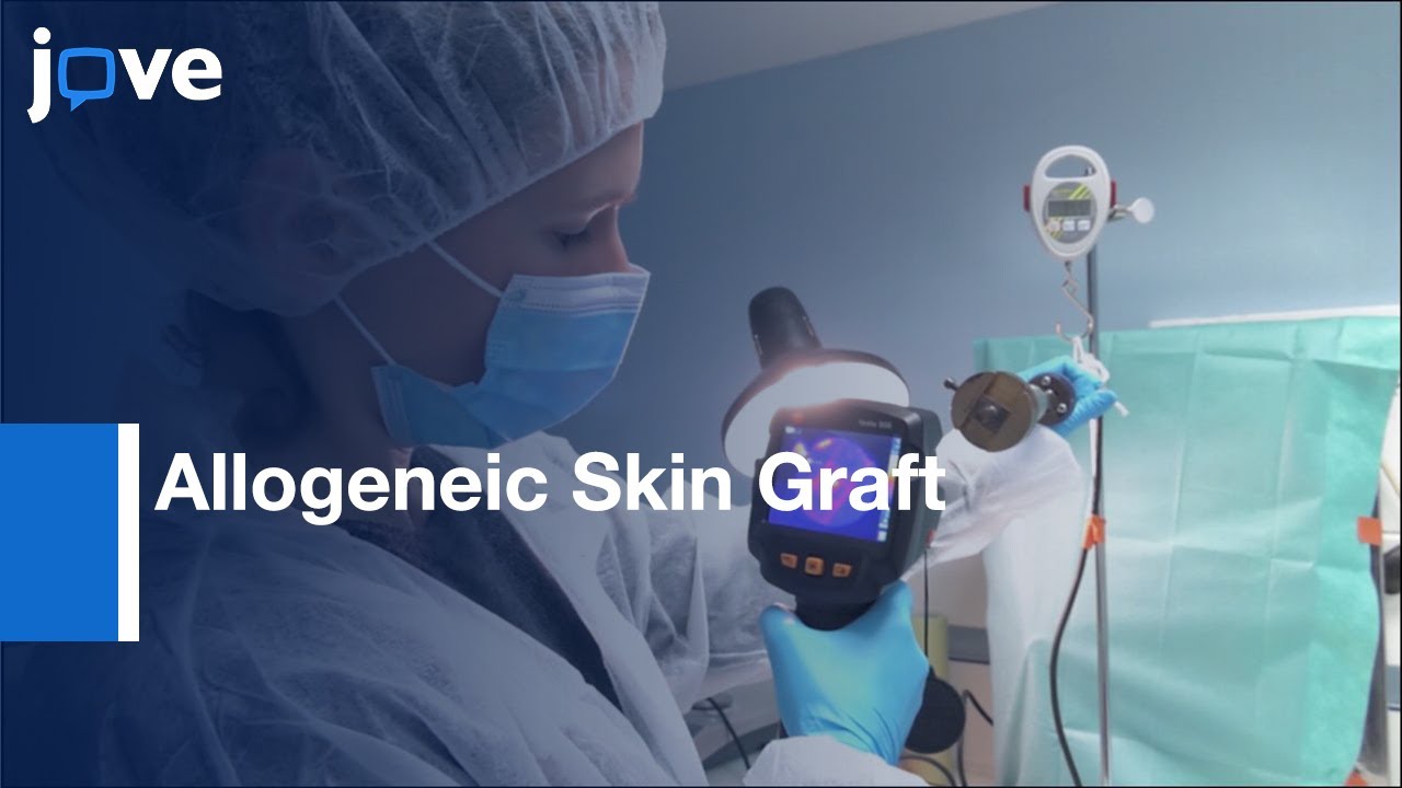 Murine Model Of Burn Wound Reconstructed With Allogeneic Skin Graft l ...