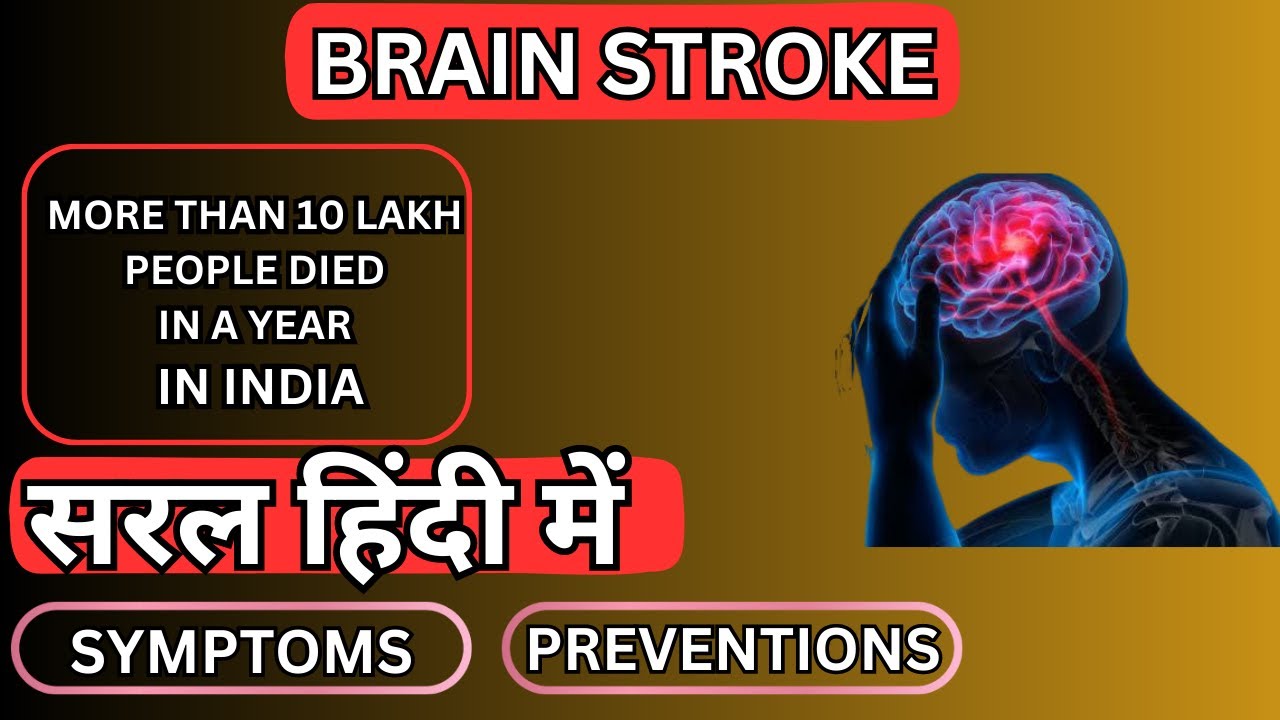 cerebrovascular diseases/brain stroke recovery time - YouTube