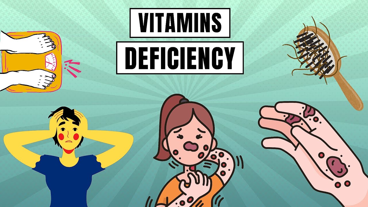 5 Signs that You have Deficiency of Vitamins - YouTube