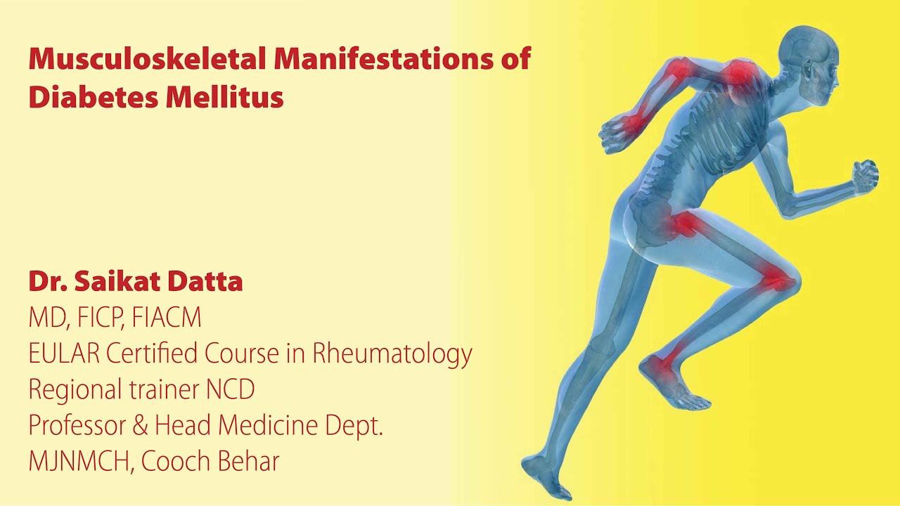 Musculo Skeletal Manifestation of DM - YouTube