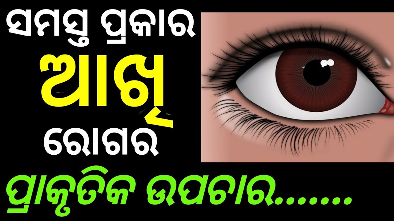 dark circle treatment of eye disease in odia/AKHI tala kaladaga ...