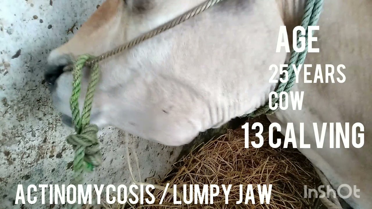 Actinomycosis/Bacterial disease/Lumpy jaw - YouTube