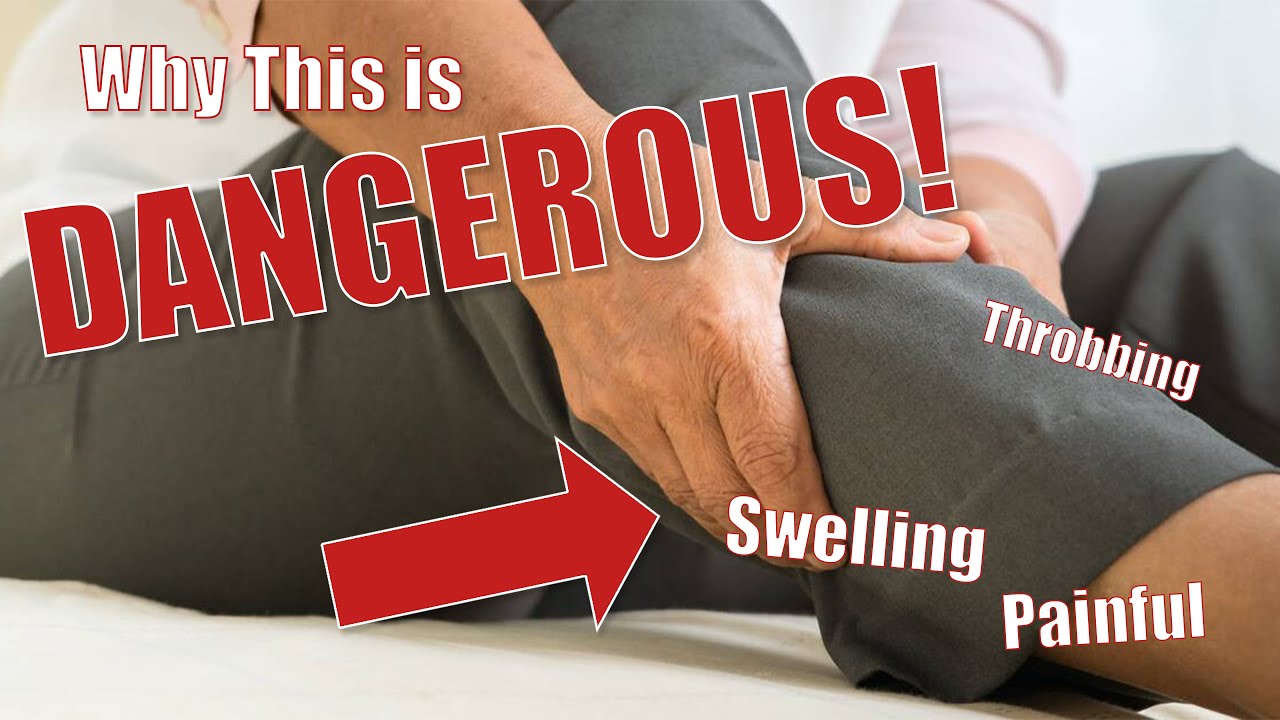 Watch Out for These Signs! - YouTube