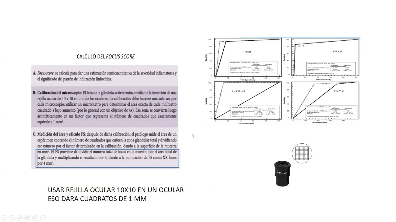 Biopsias de glándula salival: focus score - YouTube