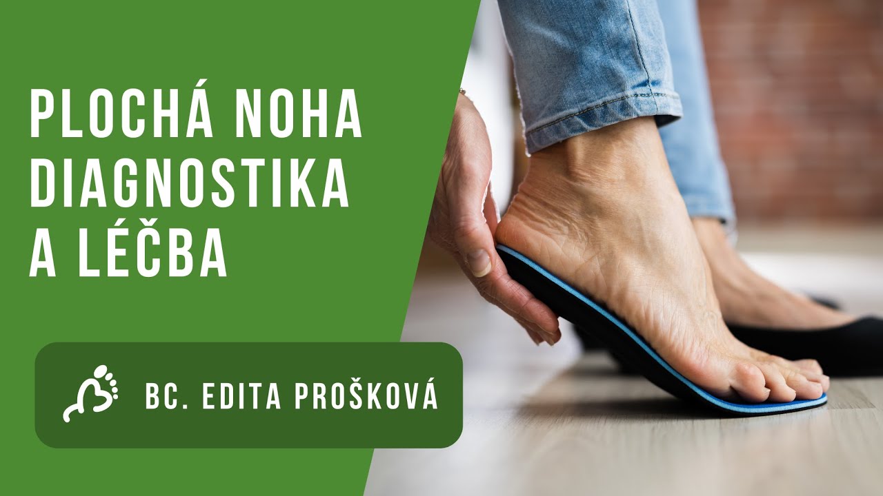 Bc. Edita Prošková: Plochá noha od diagnostiky po léčbu - YouTube