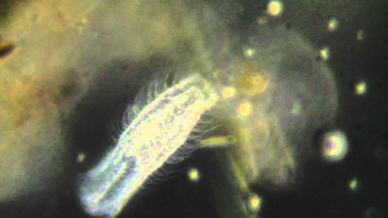 Chaetonotus, le gastrotriche (video 2) - YouTube