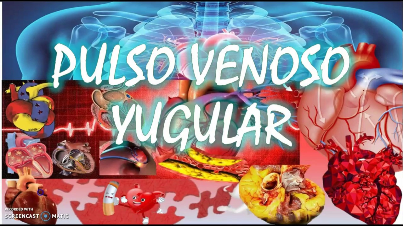 Pulso venosa yugular FÁCIL DE ENTENDER. COMO SABER DE PULSO VENOSO ...