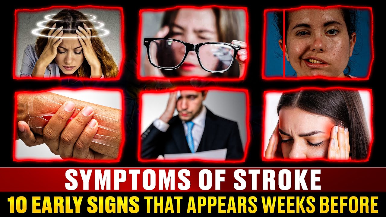 10 Early Signs of Stroke (It Shows 1 Week Before) | Symptoms Of Stroke ...