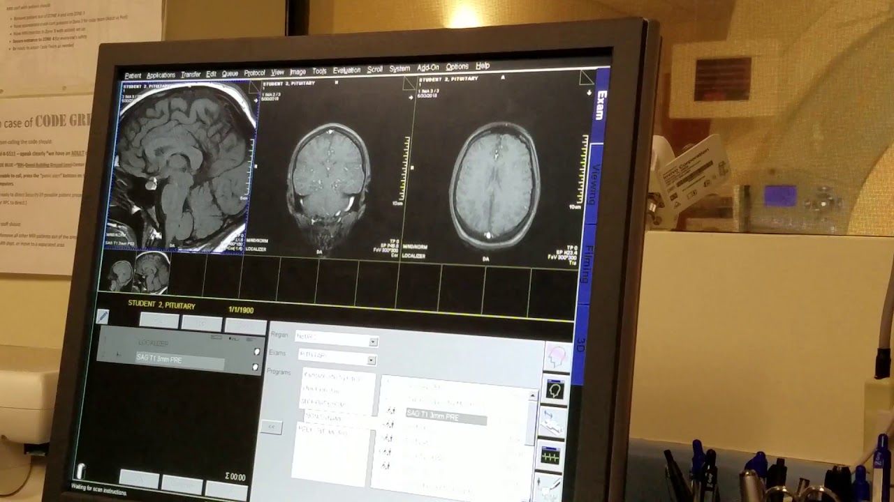 School of Medical Imaging MRI Lab Pituitary - YouTube