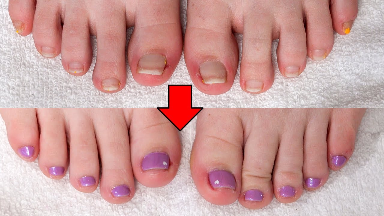 Cute from head to TOE 🦶 | DIY Pedicure FEET TRANSFORMATION! - YouTube