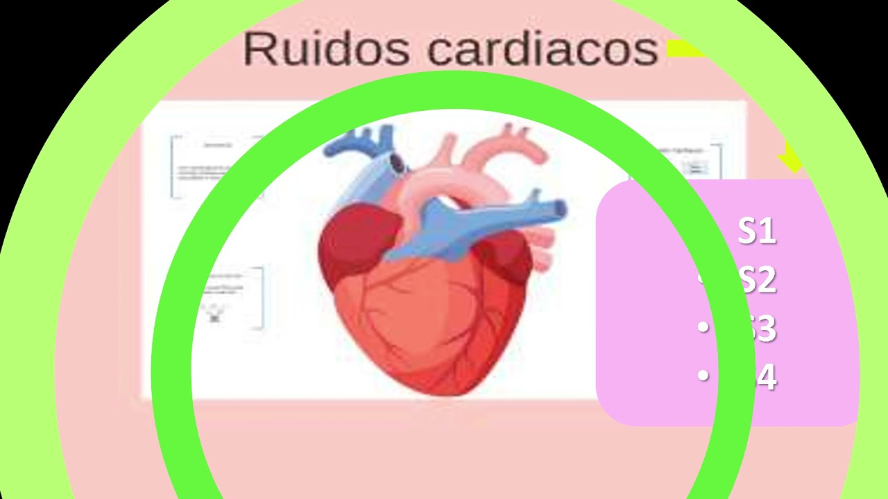 SECUENCIA DE AUSCULTACIÓN CARDIACA (TÉCNICA ADECUADA PARA AUSCULTAR LOS ...