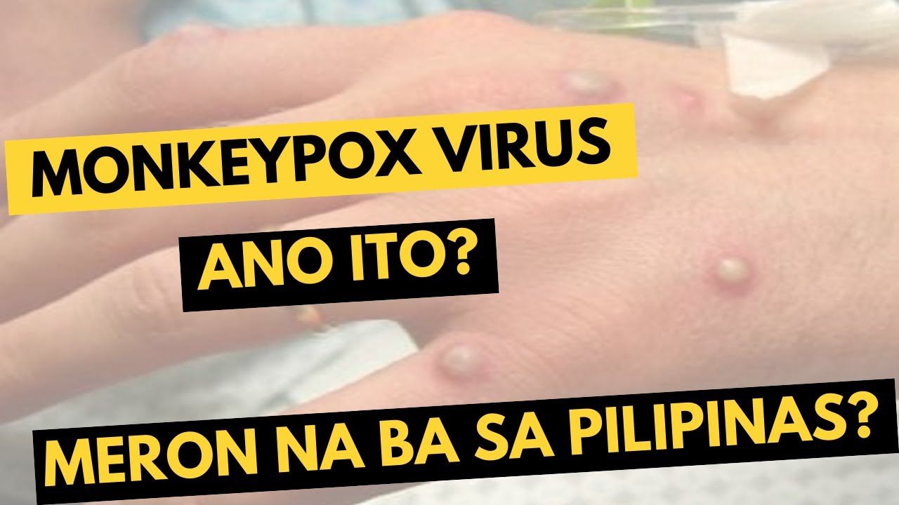 Ano ang MONKEYPOX, Paano NAKAKAHAWA, SINTOMAS, Meron na ba sa PILIPINAS ...
