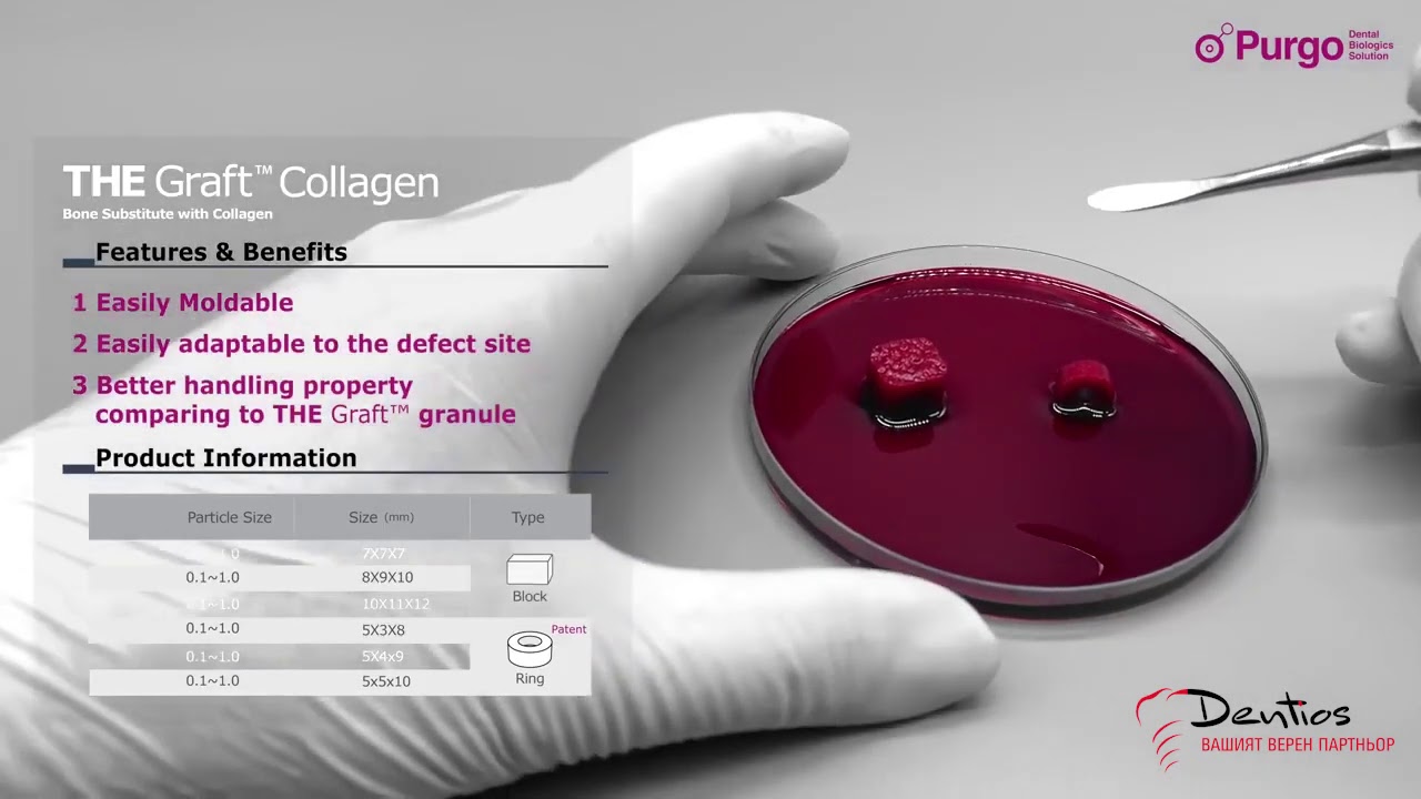 Coming SOON - LegoGraft by PURGO - Natural Bone Substitute with ...