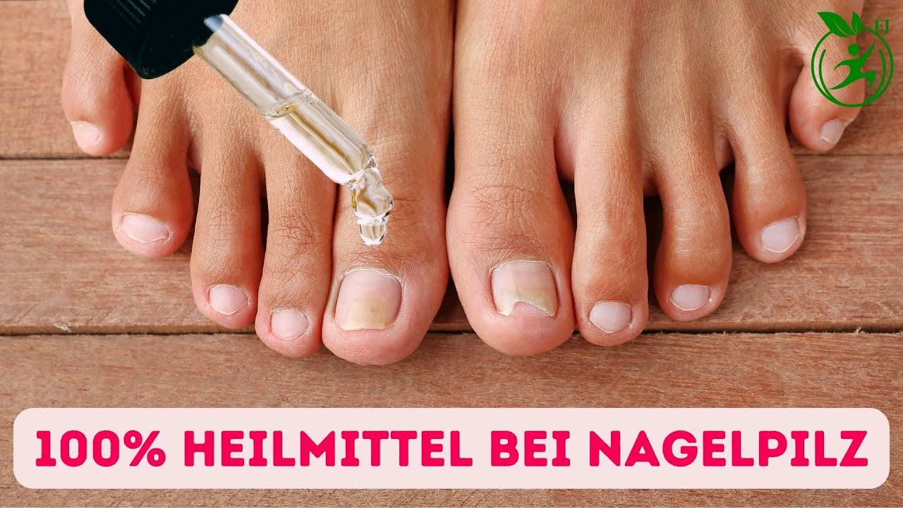 Nagelpilz Mit Essig Behandeln