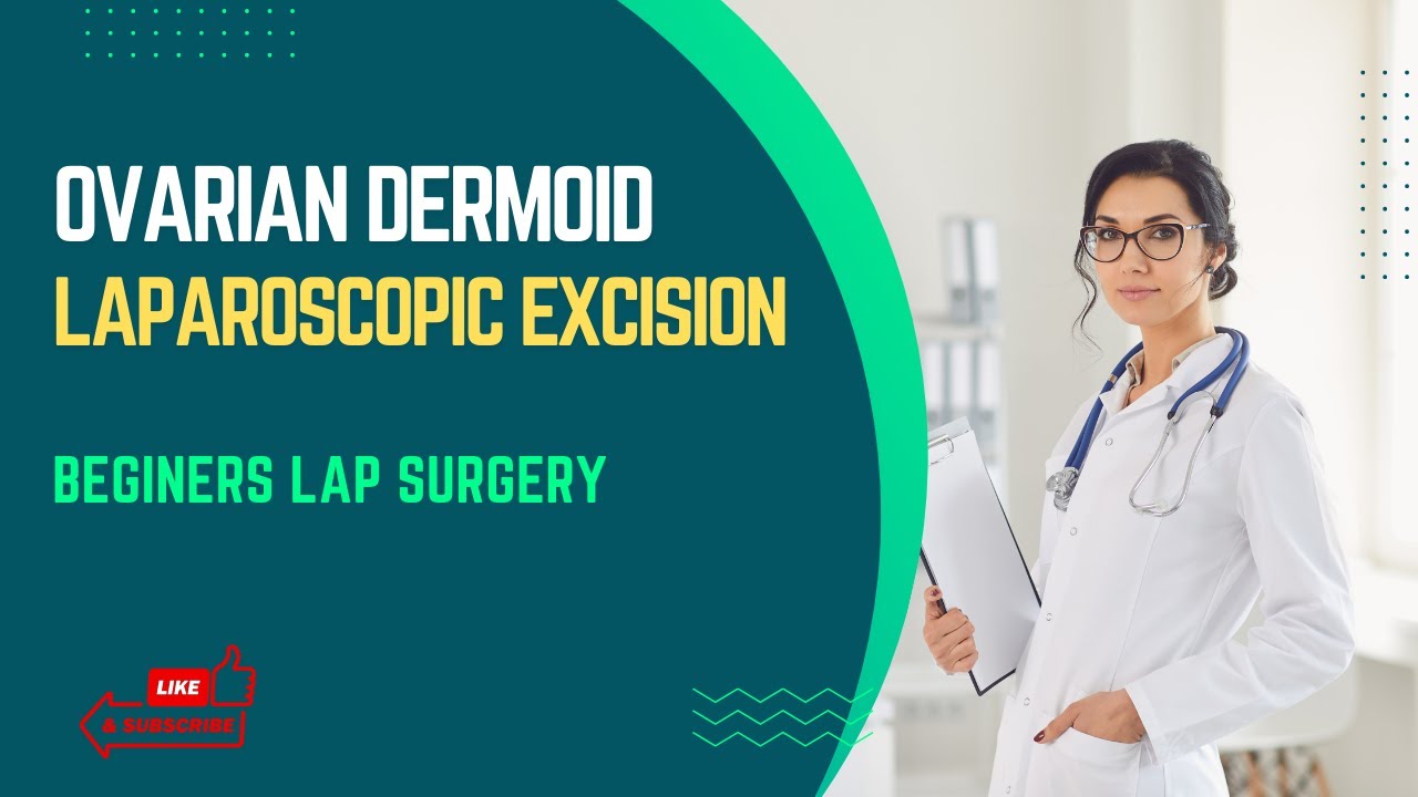Ovarian Dermoid - Laparoscopic Excision - YouTube