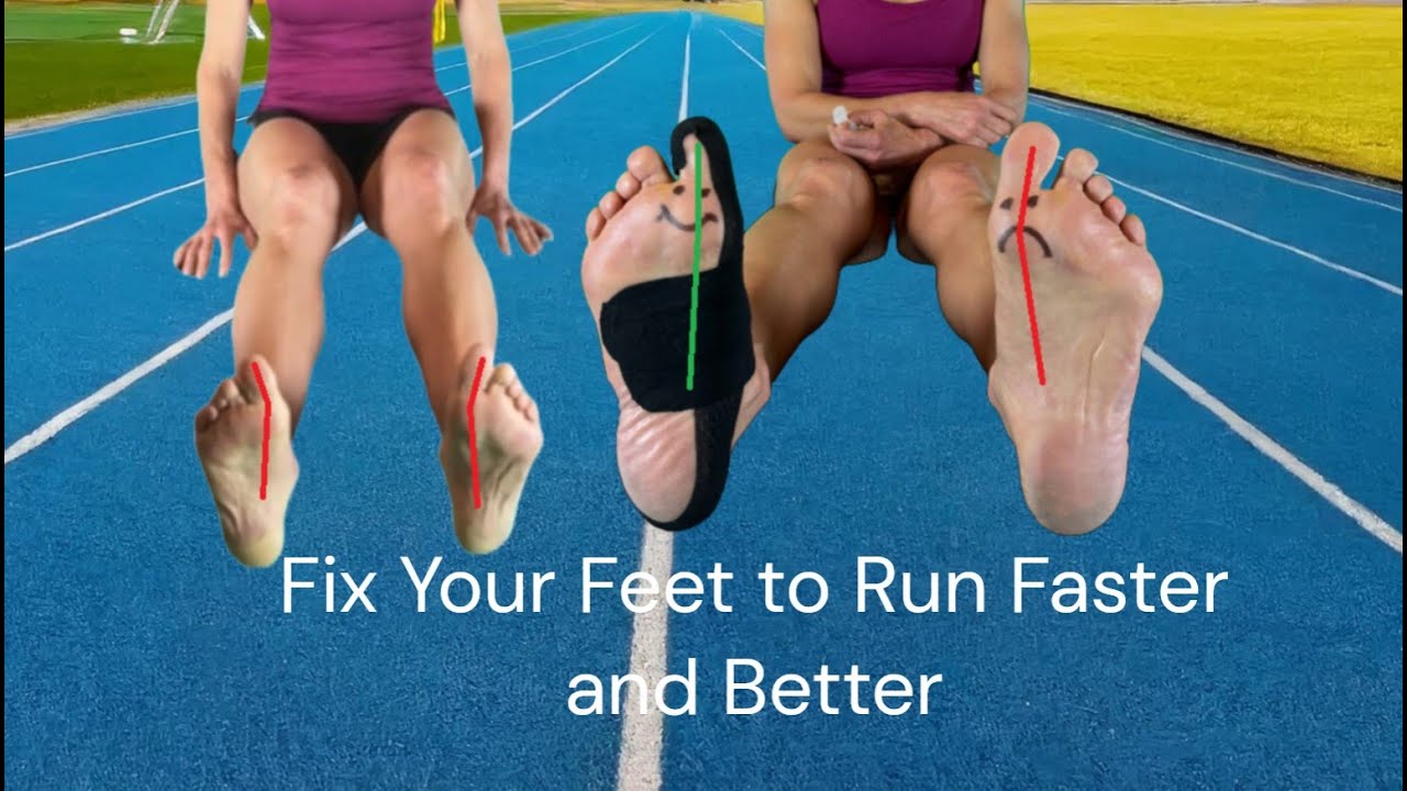 Runners Fix Your Feet to Run Faster and Better with No Foot Pain! # ...