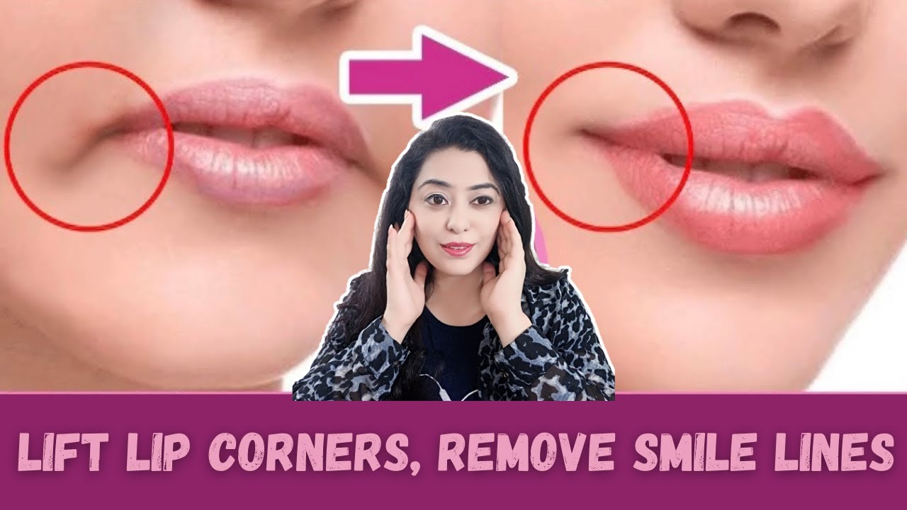 Lift Lip Corners Fix Droopy Mouth Corners Fat Around The Mouth lift-lip-corners-fix-droopy-mouth-corners-fat-around-the-mouth