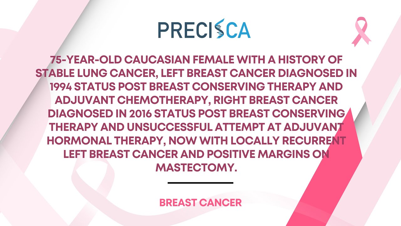 Expert Cancer Panel: Locally recurrent breast cancer s/p mastectomy ...